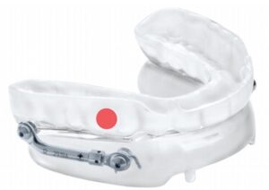 DynaFlex® Accu-Fit™ liner — eliminating costly remakes