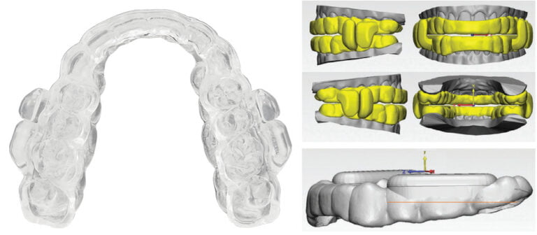 ProSomnus® EVO™ — designed to earn the trust of DSM providers