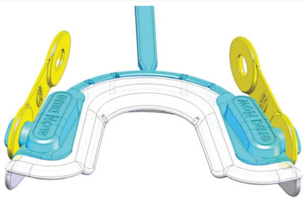 EMA dental sleep devices — a simple and inexpensive solution