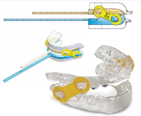 EMA dental sleep devices — a simple and inexpensive solution