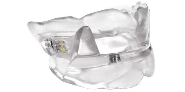 Dentures and OSA? There are options.