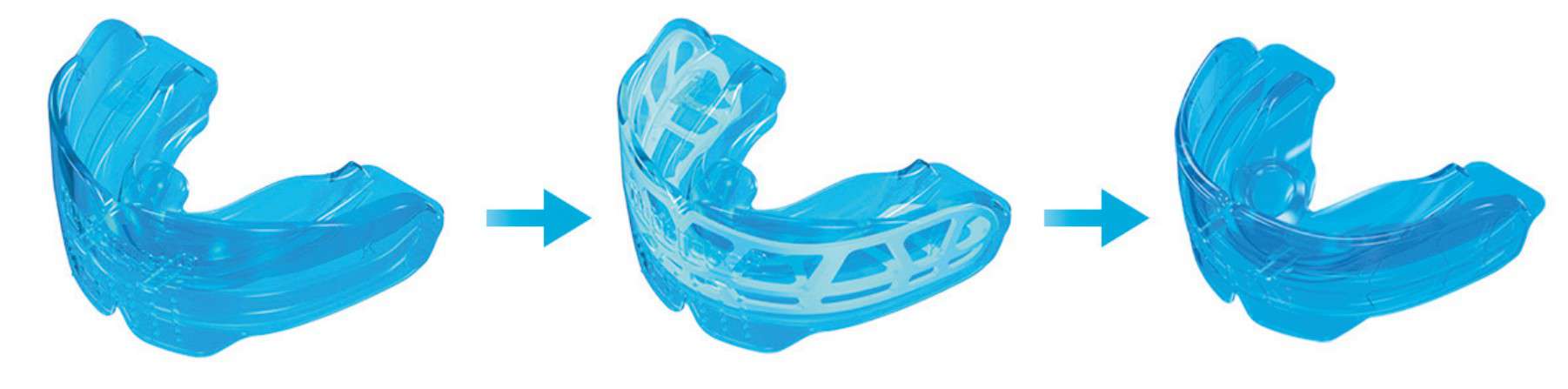 Myofunctional therapy — a non-invasive approach for sleep-breathing ...