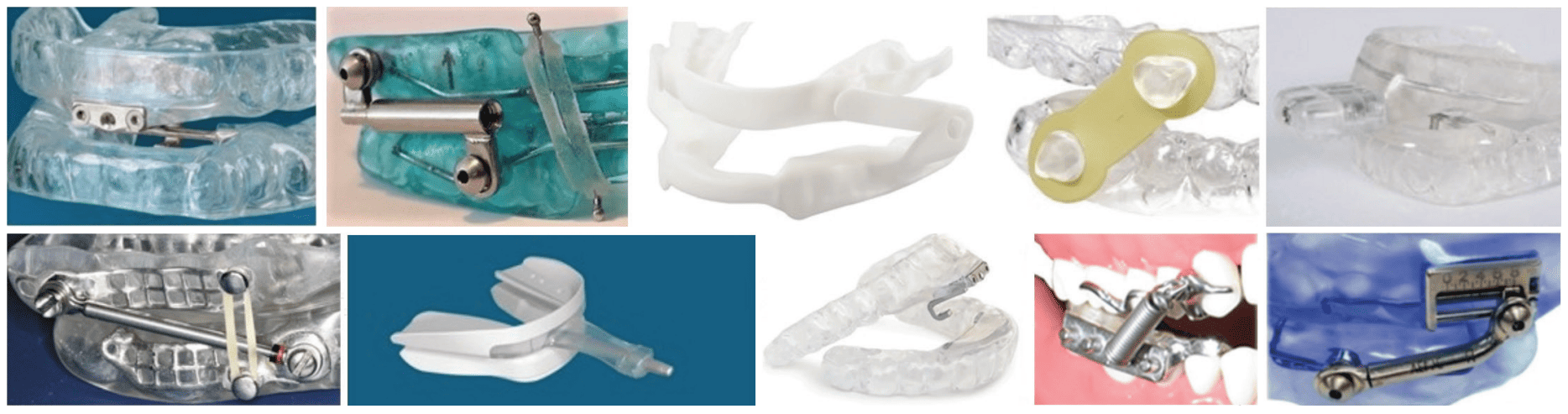 Oral physiology — key to addressing the right sleep apnea treatment