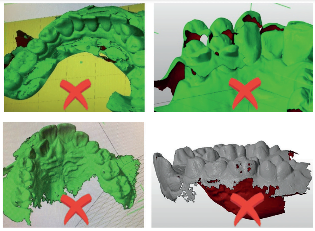 Laboratory challenges — how dentists and labs can work to avoid obstacles
