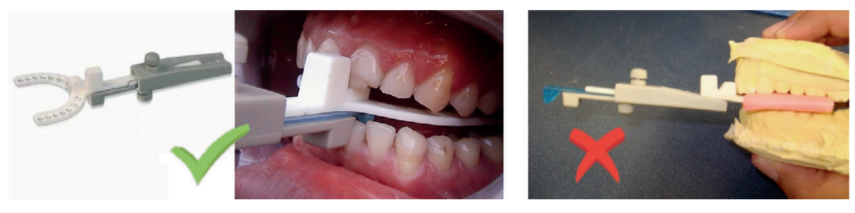 Laboratory challenges — how dentists and labs can work to avoid obstacles