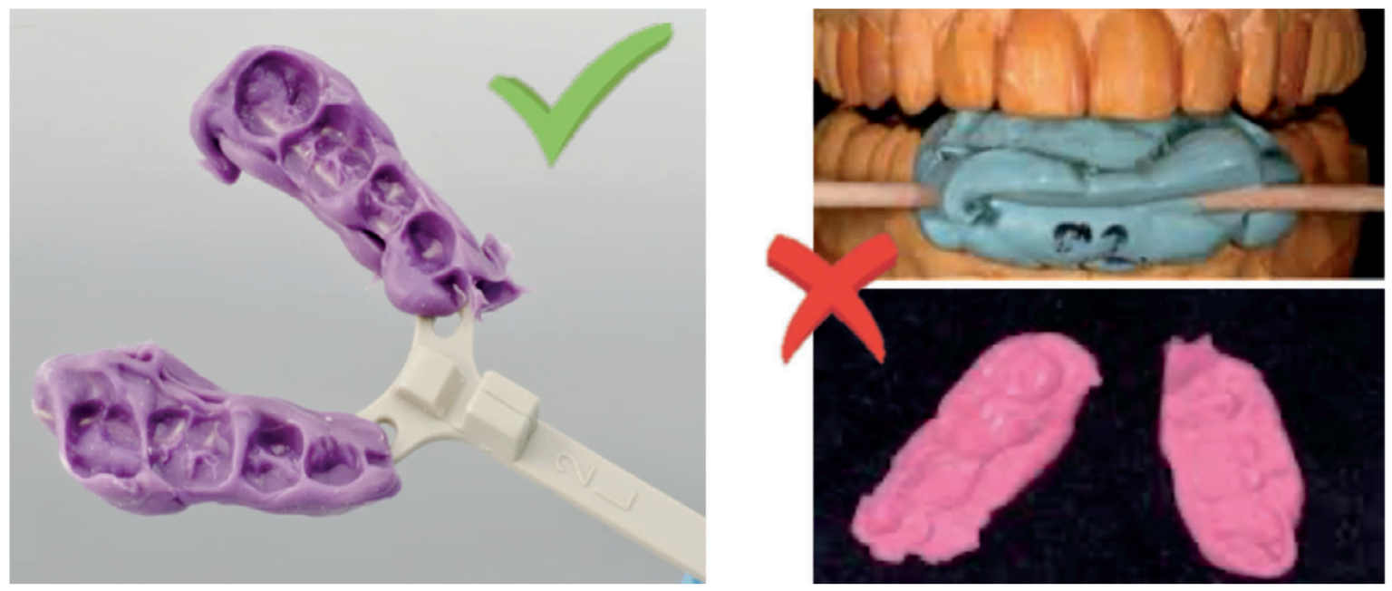 Laboratory challenges — how dentists and labs can work to avoid obstacles