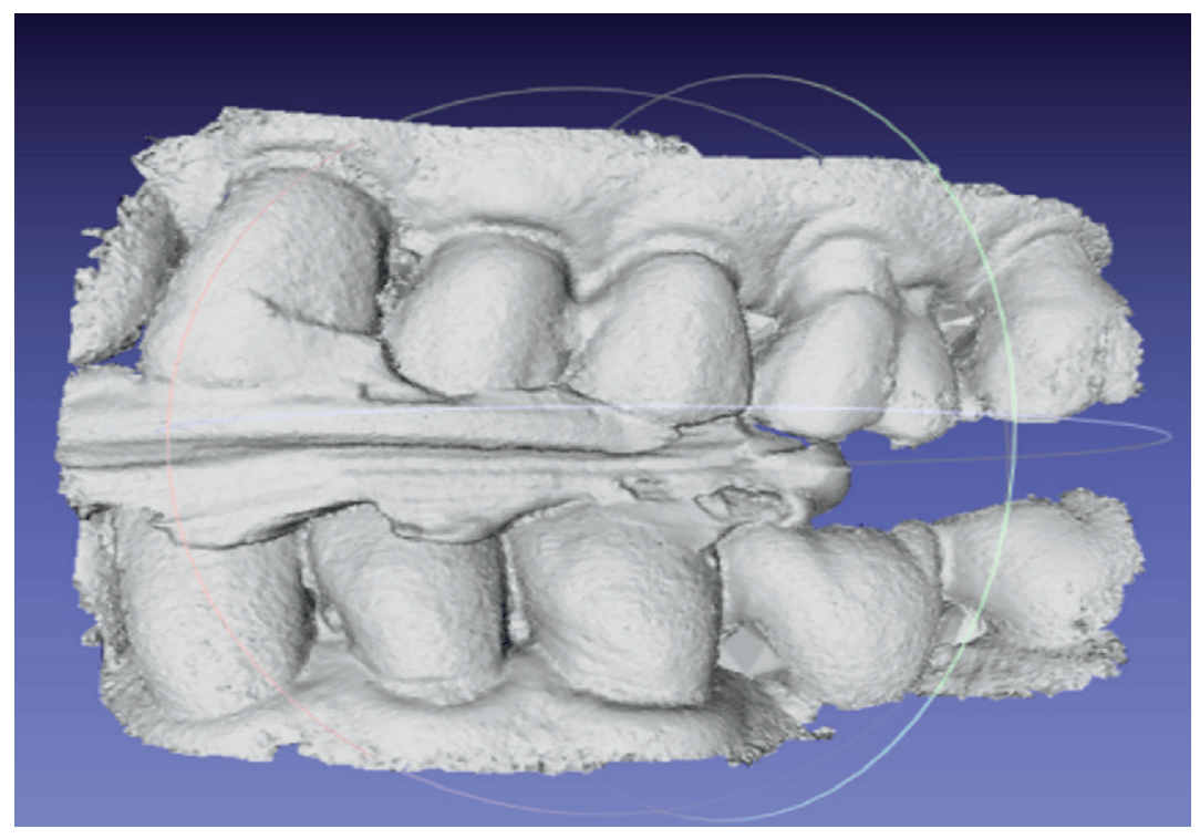 Laboratory challenges — how dentists and labs can work to avoid obstacles