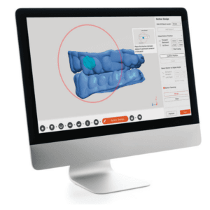 EMA 3D by LuxCreo — can bring immediate relief of sleep apnea